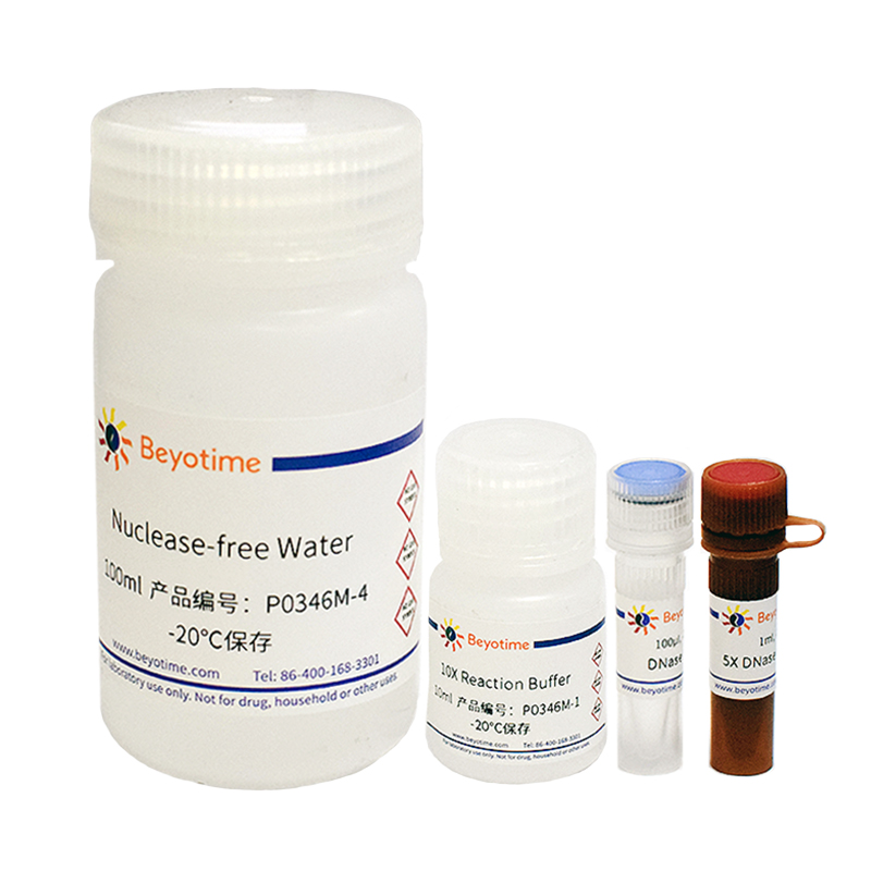 碧云天 DNase I残留检测试剂盒(P0346M)_常规试剂、生化试剂_i实验室(iallab.com)
